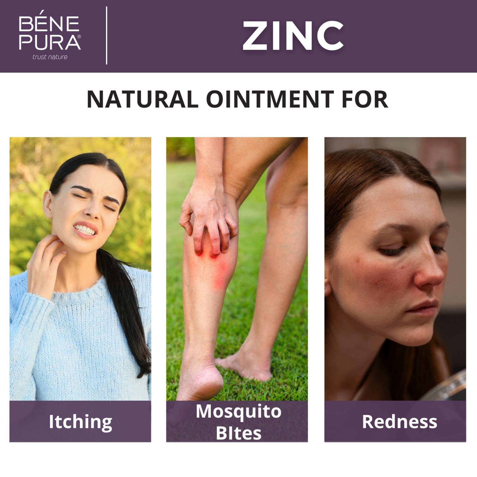 ᐉ Zinc ointment for Itching and Rashes - 40ml - Benepura.co.uk