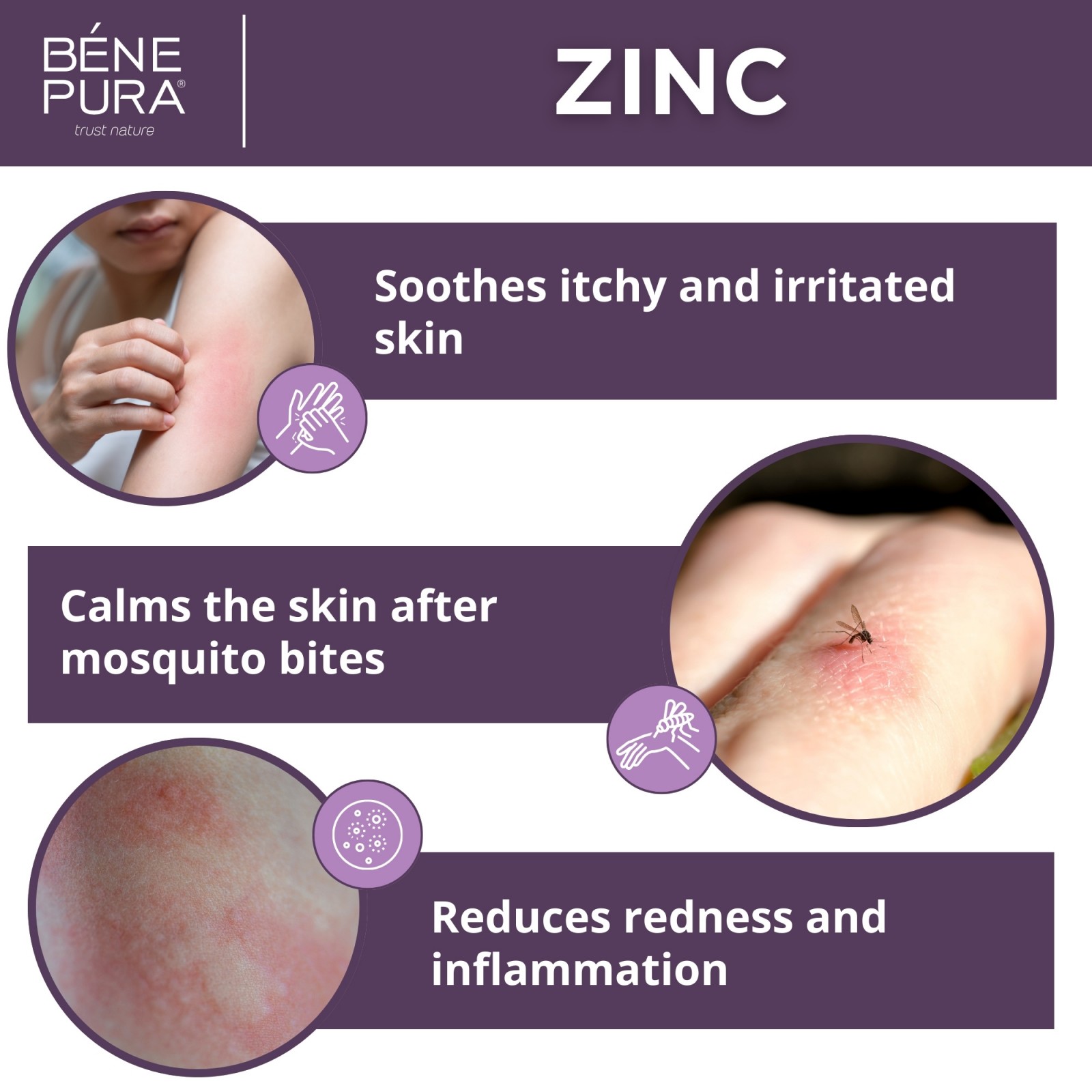 ᐉ Zinc ointment for Itching and Rashes - 40ml - Benepura.co.uk