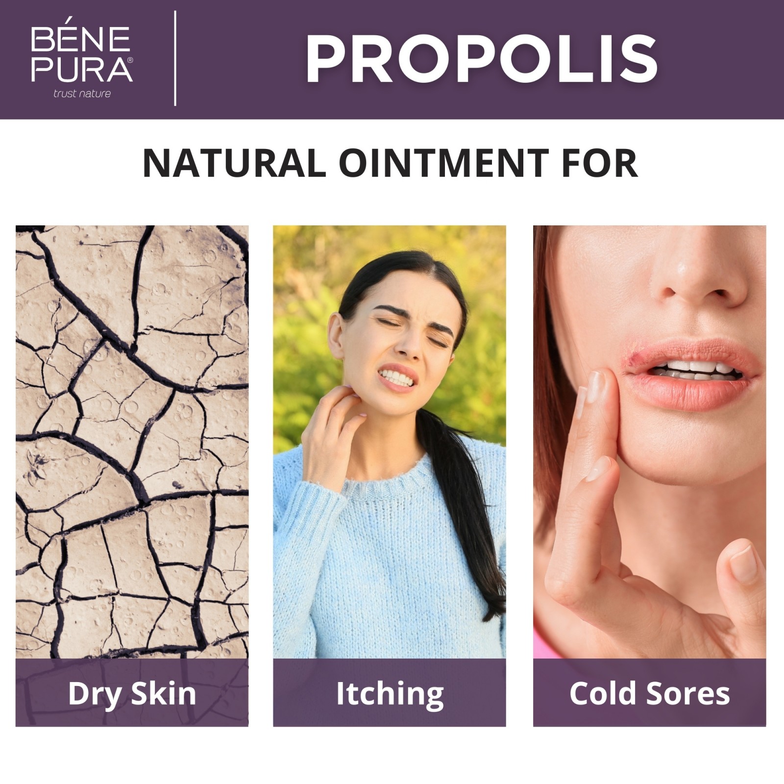 ᐉ Propolis ointment for Dry skin with 30% Propolis - 40ml - Benepura.co.uk